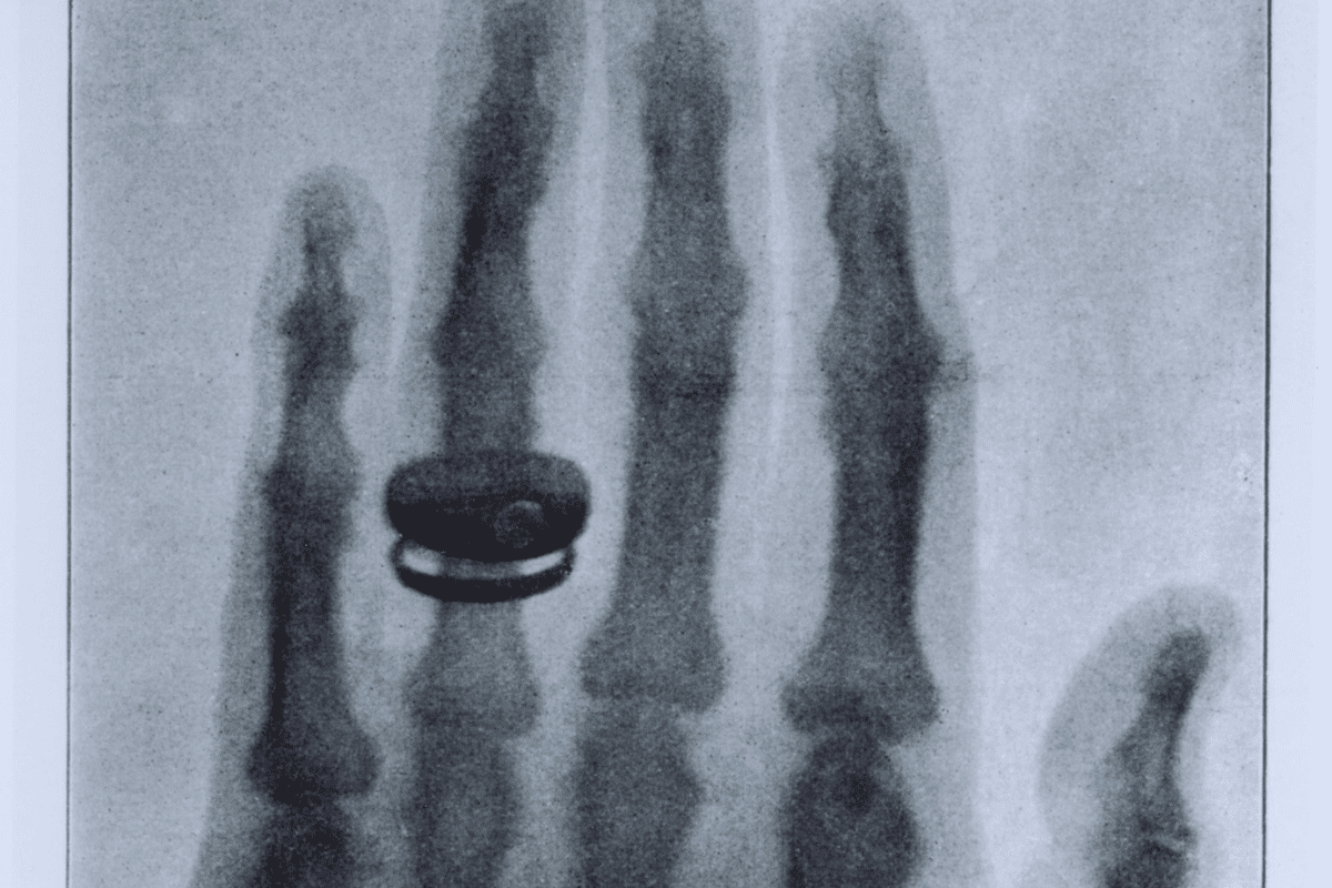 Top 14 Historical Medical Breakthroughs: A Timeline